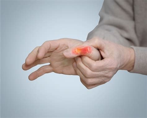 류마티스 관절염 조기 진단·전문적 치료 중요