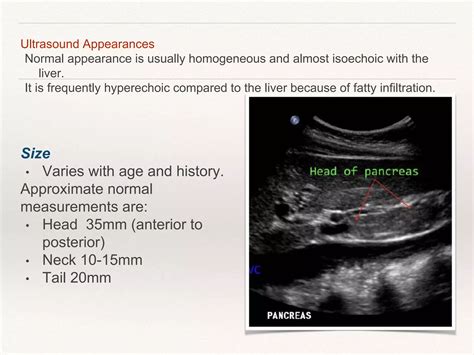 Ultrasound Of Pancreas And Spleen Pptx