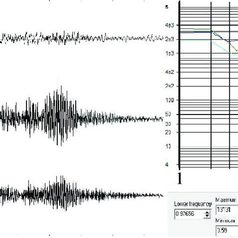 Wave Pattern And Frequency Spectrum Of Recording At The Crown Of The Download Scientific