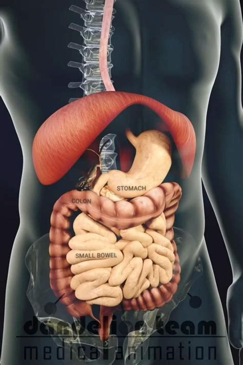 Types Of Colon Polyps And What You Should Know About Them Artofit