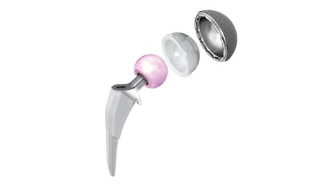 Hip Images Patient Education Resource Depuy Synthes