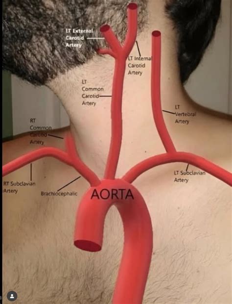 Dr Muhammed The Major Arteries Of The Neck Are Responsible For