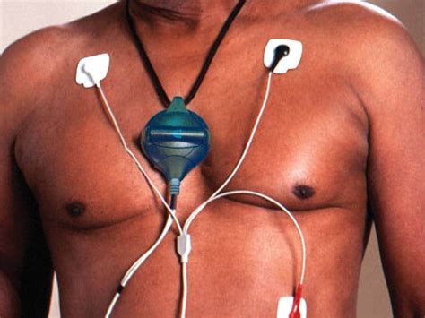 Telemetry Monitoring Lead Placement