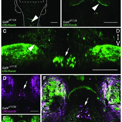 Light Field Microscopy Setup And Volumetric Imaging In Bright Field And