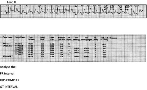 Solved Lead II Analyse The PR Interval QRS COMPLEX QT Chegg Com