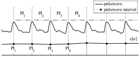 Pulse Wave And Pulse Wave Interval Download Scientific Diagram