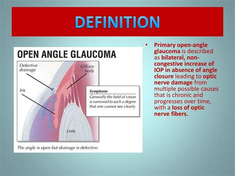 What Does Primary Open Angle Glaucoma Look Like At Tami Lumley Blog
