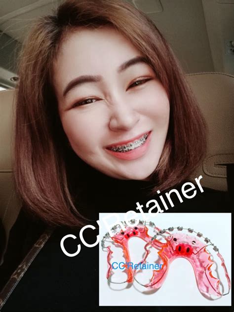 ขอบคุณรีวิวสวยๆจร้า😘 ส่งจริงไม่โกงจร้า😘 👄รีเทนเนอร์แบบ ท่อลวดอะครีลิค ลวดเปล่า👄 ชิ้นละ 600 บาท