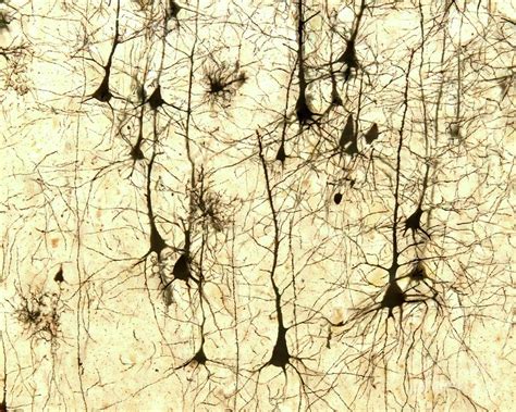 Pyramidal Cells 2 By Science Photo Library