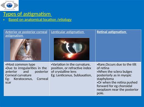 Astigmatism Pptx Pptx