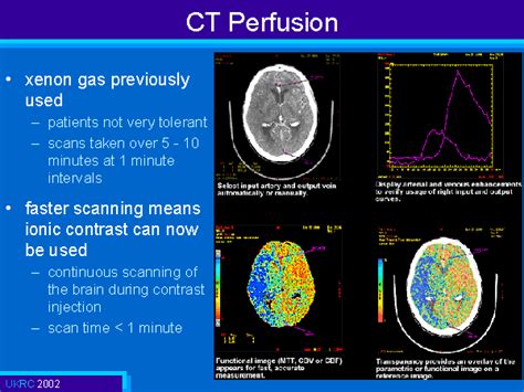 Ct Perfusion