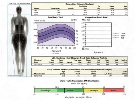 Dxa Scan Results