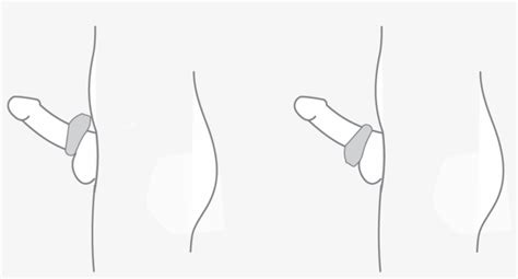 Pivot Positions X PNG Download PNGkit