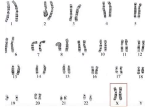 Ap 2 Lab Ch 13 Part 2 Flashcards Quizlet Ap 2 Lab Ch 13 Part 2 Flashcards Quizlet