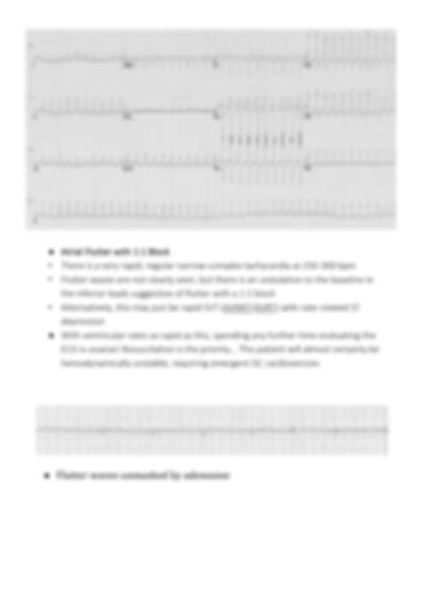 Solution Atrial Flutter Studypool