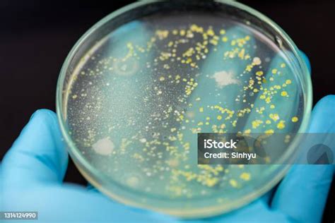 미생물학 실험실에서 교육을 위한 토양 샘플에서 천접시에서 자라는 특성과 다양한 모양의 박테리아 및 곰팡이 의 배경 마이크로 생물체에 대한 스톡 사진 및 기타 이미지 Istock