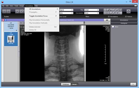 25 Free And Open Source Dicom Viewers For Windows