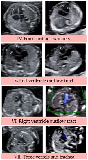 First Trimester Ultrasound Imaging For Prenatal Assessment Of The