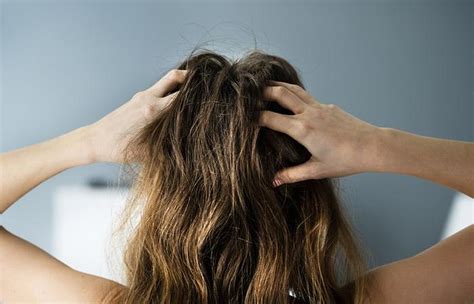 Scalp Buildup Causes Treatment And Prevention
