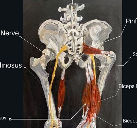 Differentiation Of Hamstring Tendonitis And Strains V