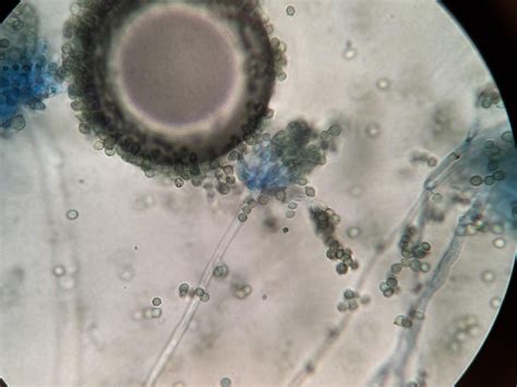 Aspergillus Slide View