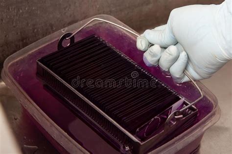 Scientist Staining Microscope Slides For Cytology Studies In The Scientist Staining Microscope Slides For Cytology Studies In The