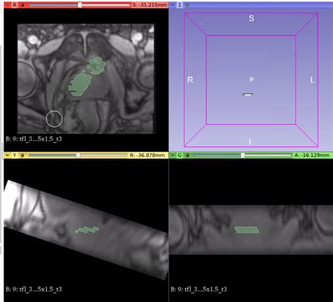 Dicom Import And Image Does Not Appear Support 3d Slicer Community