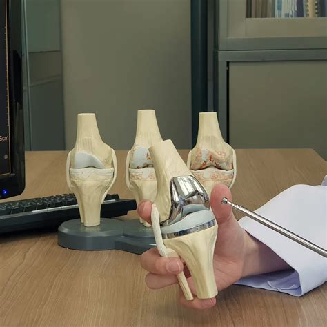 Ρευματοειδής Αρθρίτιδα Αίτια Διάγνωση And Θεραπεία Κ Σαράντος