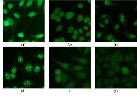Figure 1 From An Automatic Hep 2 Specimen Analysis System Based On An Active Contours Model And