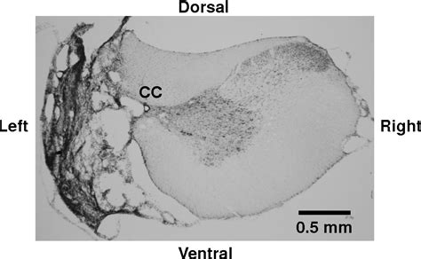 Figure 1 From Effects Of Serotonergic Agents On Respiratory Recovery After Cervical Spinal
