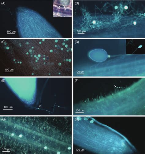 Phytophthora Sojae Structures In Soybean Roots Cv Hikmok Obtained By Download Scientific