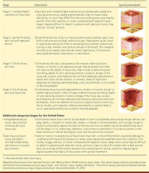 What Is A Pressure Ulcer Npuap At Darlene Colon Blog