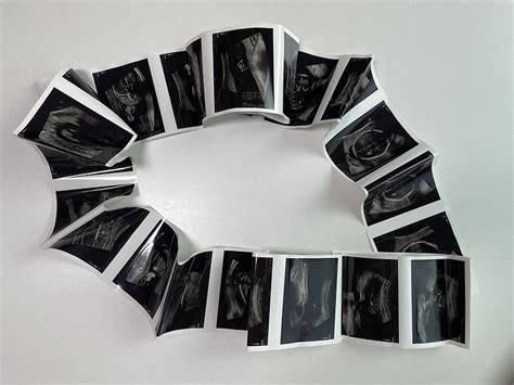 임신일기 임신 20주차 강북삼성병원 분만병원으로 전원임신20주 정밀초음파