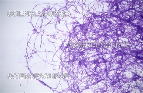 Clostridium Perfringens Lm Stock Image Science Source Images