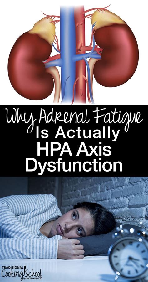 Why Adrenal Fatigue Is Actually Hpa Axis Dysfunction Artofit