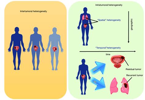 Scheme Of Tumor Heterogeneity Morphologic And Functional Differences