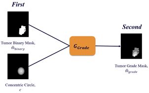 GitHub KSH BrainTumor