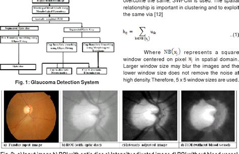 Figure 9 From Segmentation Of Optic Nerve Head For Glaucoma Detection Using Fundus Images