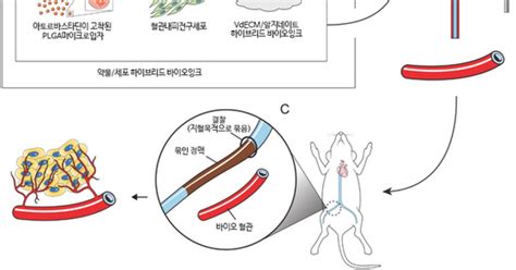 동맥경화 환자에 희소식 사람 혈관도 3d프린터로 찍어 내 옮겨심는 시대 온다
