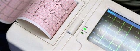 Sinus Node Dysfunction Causes Symptoms And More