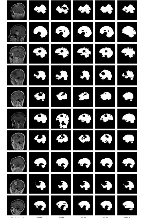 Comparison Of Brain Segmentation Results For The Ten Datasets The