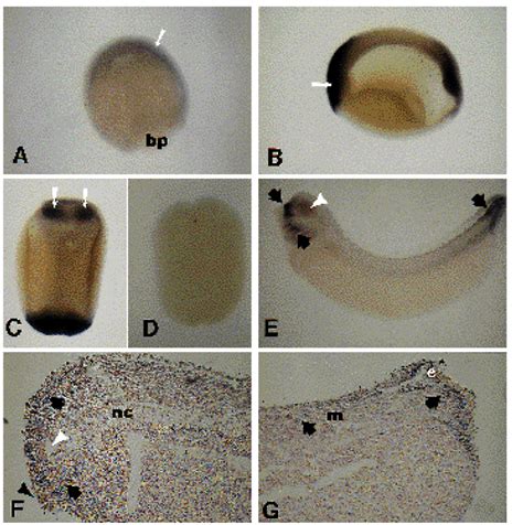 Localization Of Xwnt 5a Transcripts By Whole Mount In Situ Download Scientific Diagram