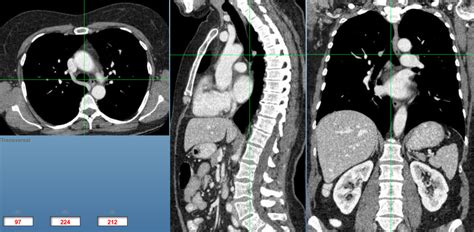 Ct Scan 3 Planes Female C1 Diagram Quizlet