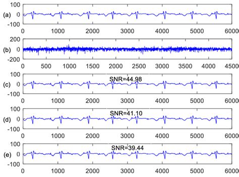 The Picture Is Part Of Using Compressed Sensing Theory To Compress And Download Scientific