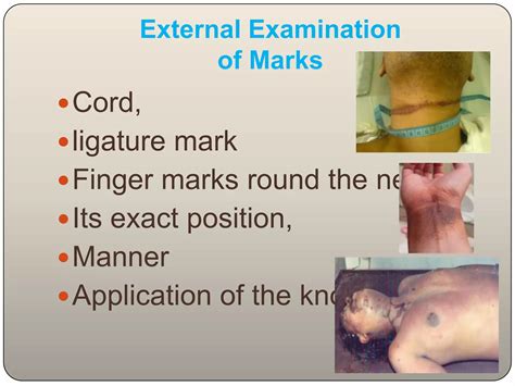 Post Mortem Examinationautopsy Pptx