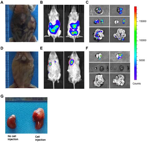 Different Tumorigenicity And Distinct Metastasis And Gene Signature Between Orthotopic And