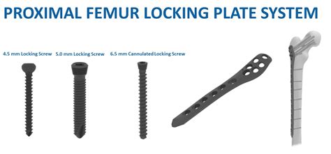 Proximal Femur Locking Plate System Aslp