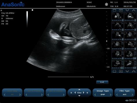 Ultrasound Color Doppler Quality Continuous Wave Cw And Two Probes C7