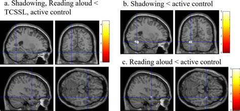 The Effect Of Training On Working Memory Related Activity The Results Download Scientific
