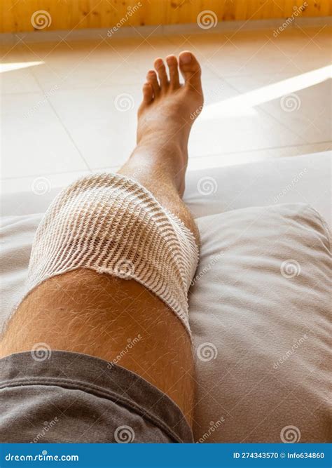 Vertical Pov Looking Down At Your Knee Wrapped In Bandages After